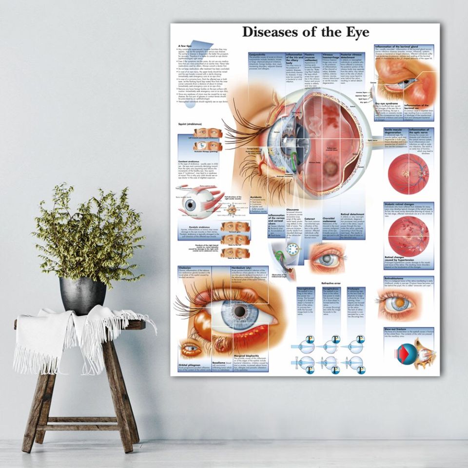 Diseases Of The Eye Chart - The Canvas Museum